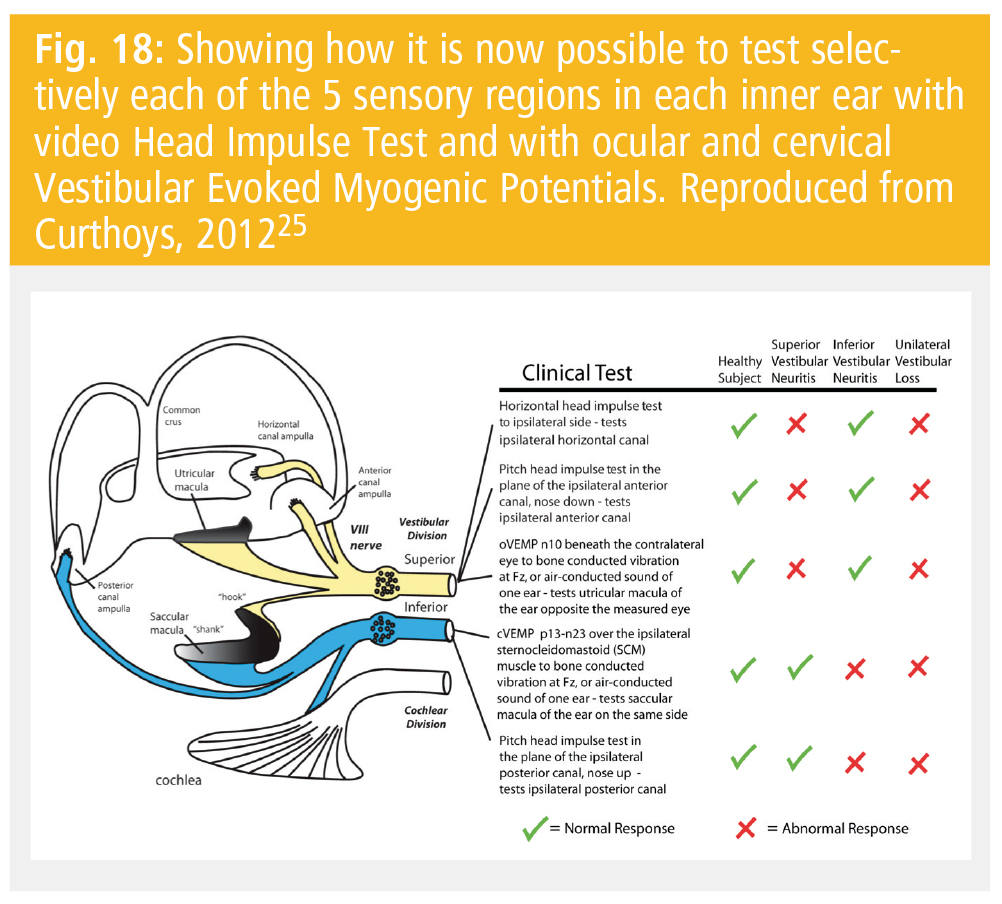 Vestibular function testing | Neurologisch | MedMedia