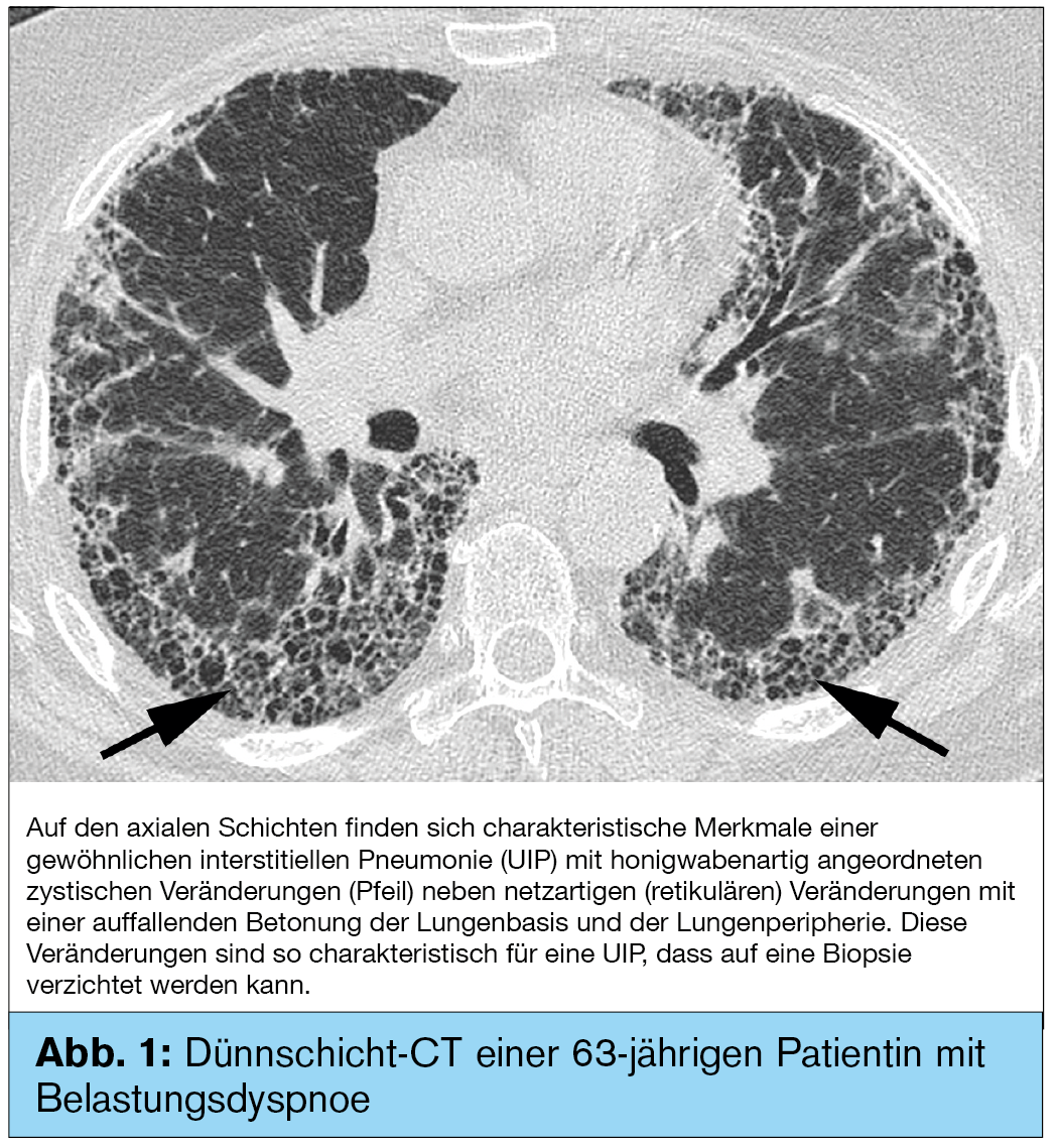 aus Sicht der Radiologie | Universum Innere Medizin | MedMedia